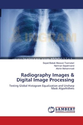 Radiography Images & Digital Image Processing + NEMOKAMAS ATVEŽIMAS!