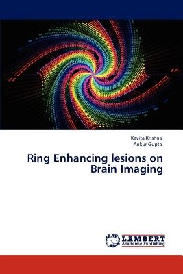 Ring Enhancing Lesions on Brain Imaging | Knygos.lt