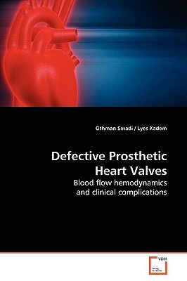 Defective Prosthetic Heart Valves | Knygos.lt