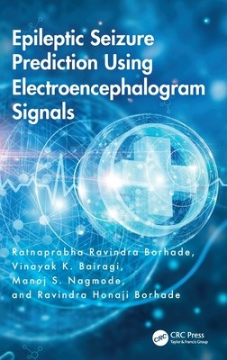 Epileptic Seizure Prediction Using Electroencephalogram Signals + NEMOKAMAS ATVEŽIMAS!