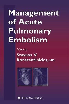 Management of Acute Pulmonary Embolism | Knygos.lt