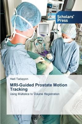 MRI-Guided Prostate Motion Tracking | Knygos.lt